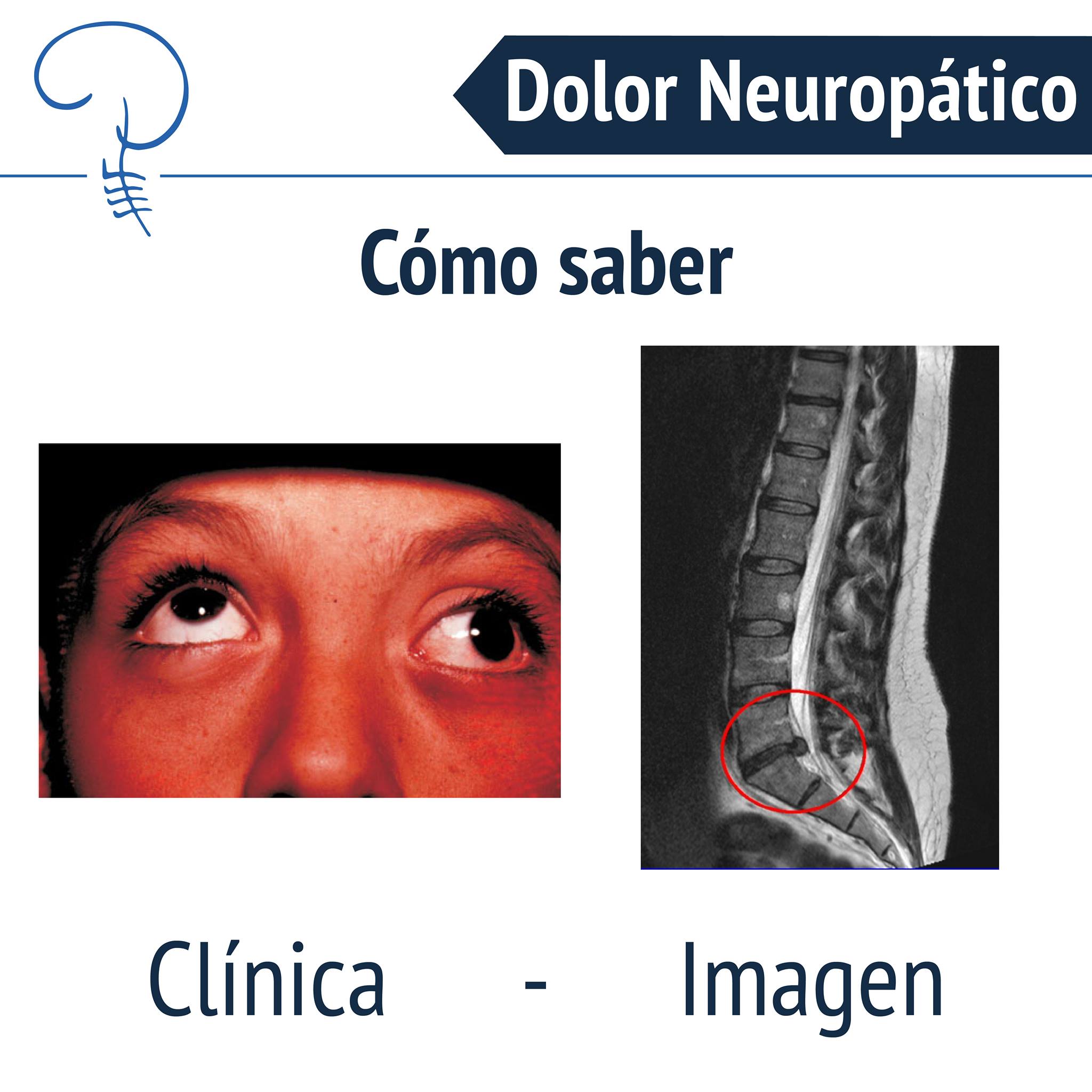 Dolor Neuropático – Dr. José Luis Gallegos Barredo
