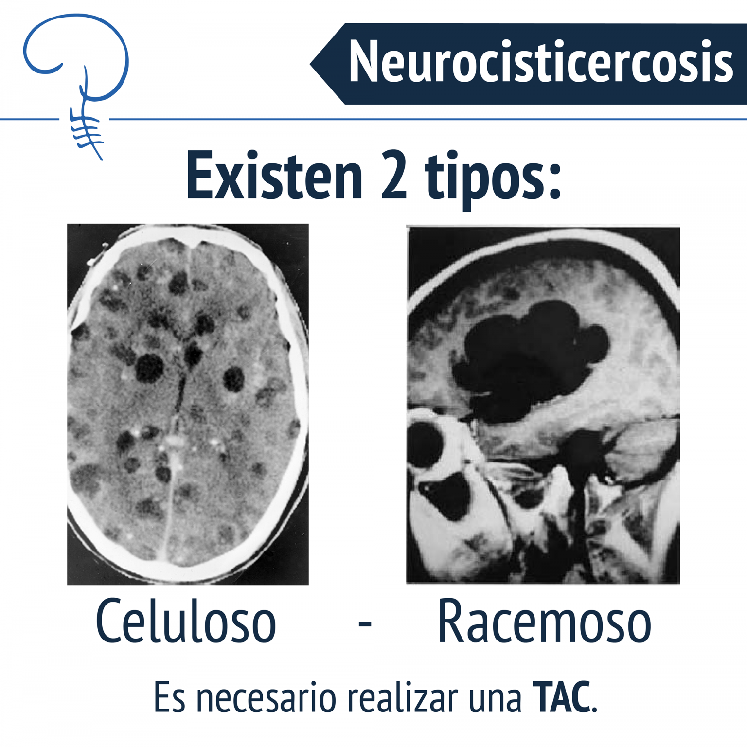 Neurocisticercosis – Dr. José Luis Gallegos Barredo